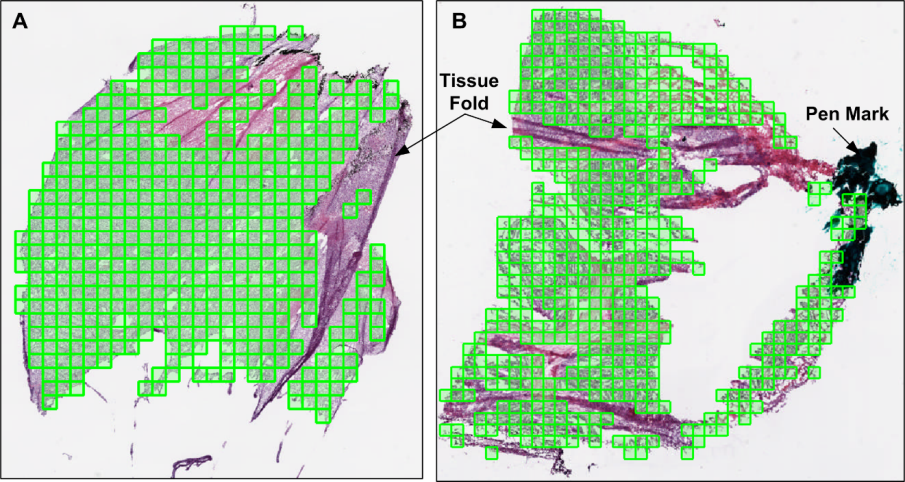 WSI Quality Control | Bio-MIBLab